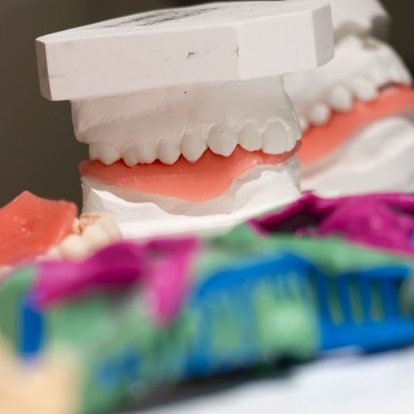 Prótesis dental removible: Información y tratamiento - Vilabiosca